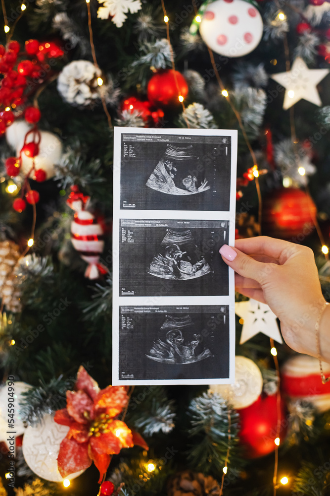 Image of an ultrasound scan of pregnancy collage of three on the ...