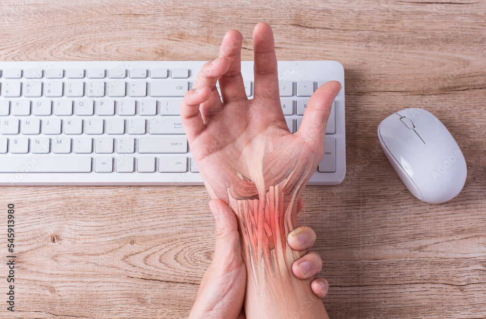 hand muscle inflammation from office syndrome , hand muscle pain Stock ...