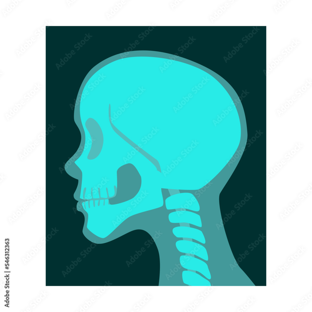 Ray of human skull side view vector illustration. Bones of skeleton ...