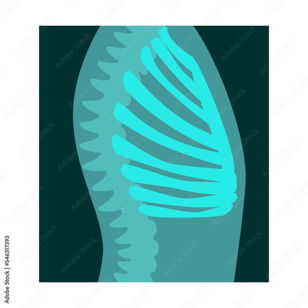 Ray of human rib cage vector illustration. Bones of skeleton, roentgen ...