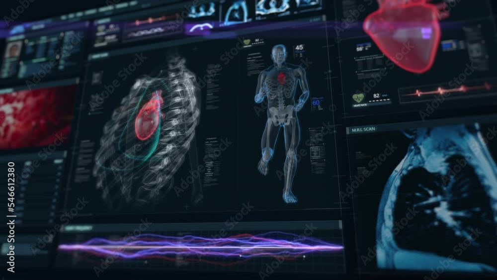 Futuristic HUD Interface Showing Anatomy Of Human Heart. Patient ...