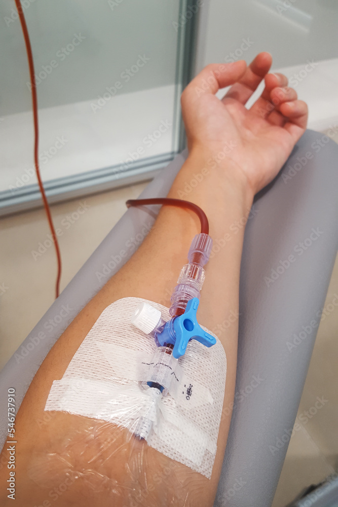 Blood draw in an arm Stock Photo | Adobe Stock