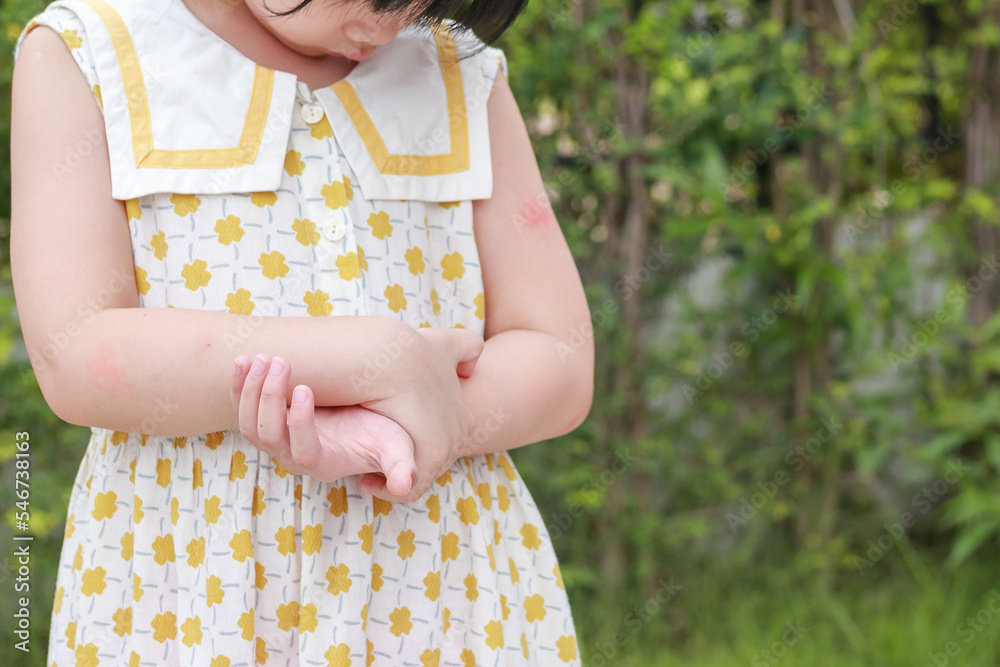 Little girl has skin rash allergy itching and scratching on her arm ...