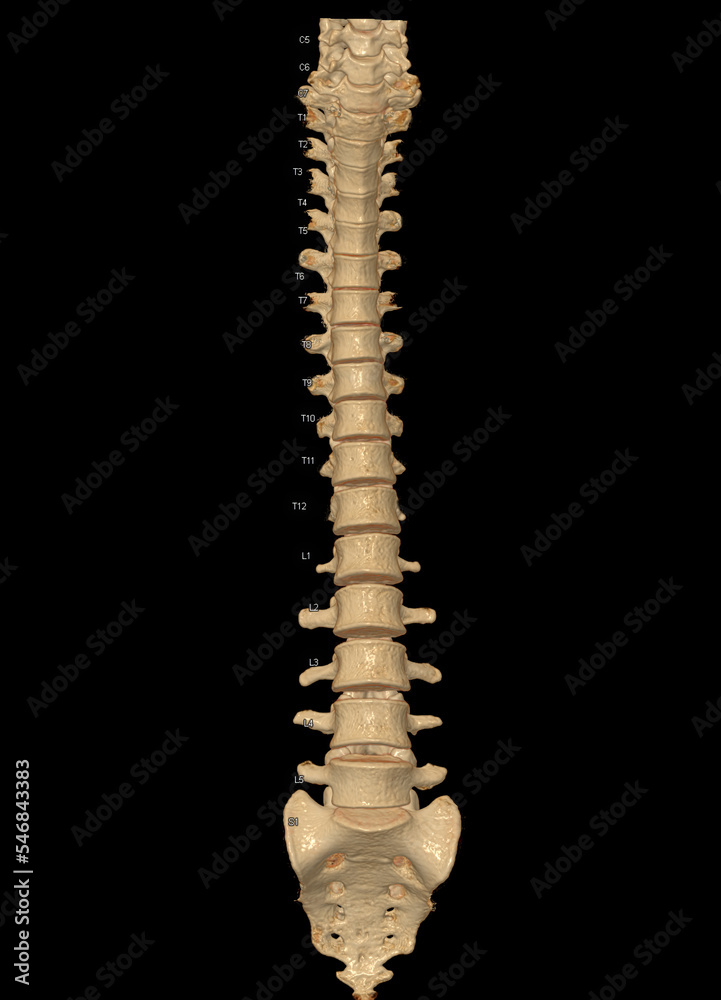 CT scan of Whole spine 3D rendering showing Profile Human Spine. Stock ...