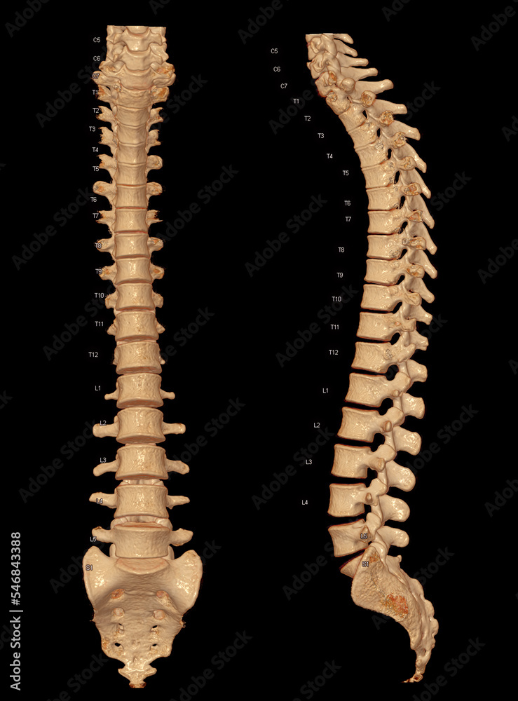 CT scan of Whole spine 3D rendering showing Profile Human Spine. Stock-Illustration | Adobe Stock