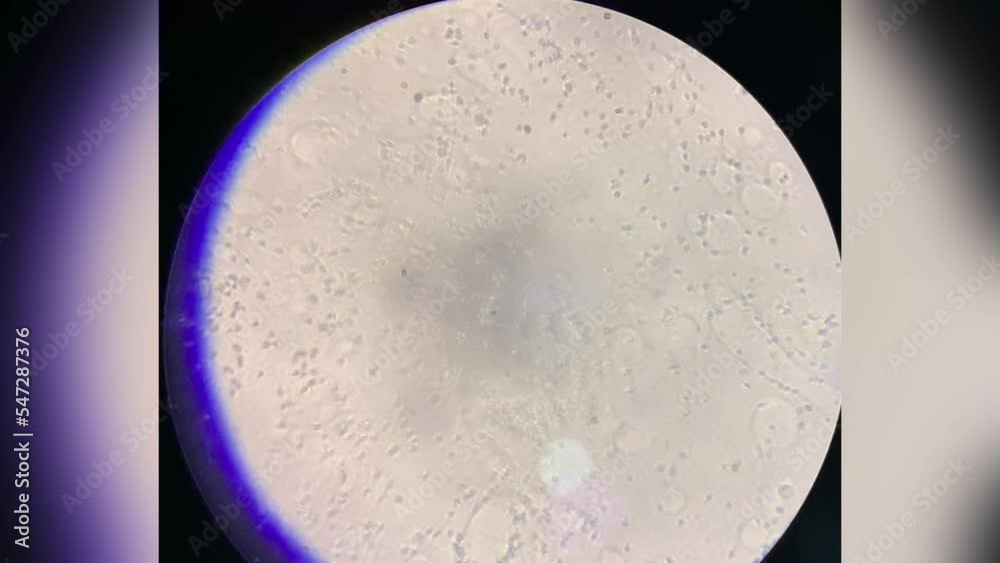 Human sperm under microscope 40x magnification, macro view through ...