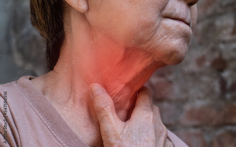 Redness at neck of Asian woman. Concept of sore throat, pharyngitis ...