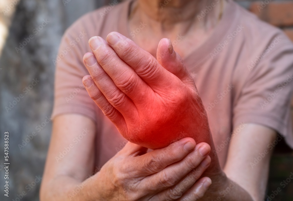 Hand joints inflammation. Concept of rheumatic arthritis, rheumatism ...