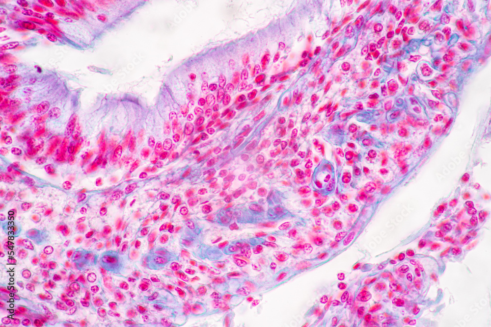 Backgrounds of Characteristics Tissue of Stomach Human, Small intestine ...