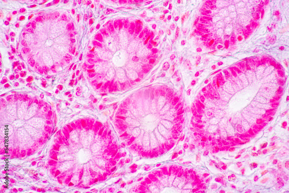 Backgrounds of Characteristics Tissue of Stomach Human, Small intestine ...