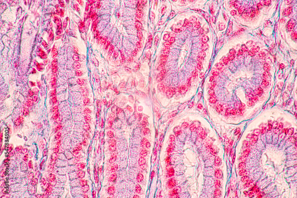 Backgrounds of Characteristics Tissue of Stomach Human, Small intestine ...