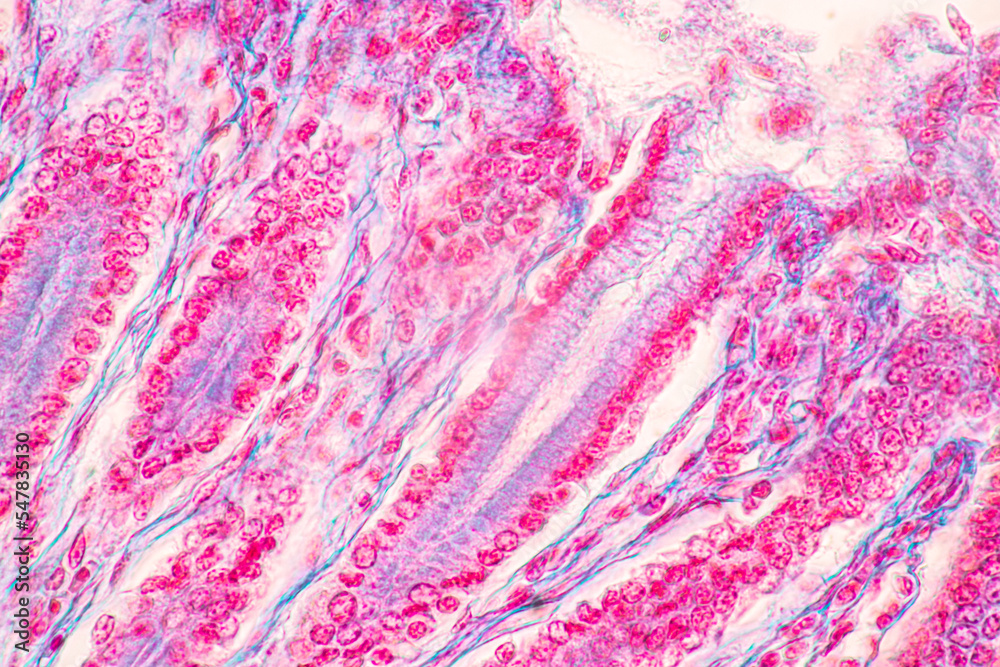 Backgrounds of Characteristics Tissue of Stomach Human, Small intestine ...