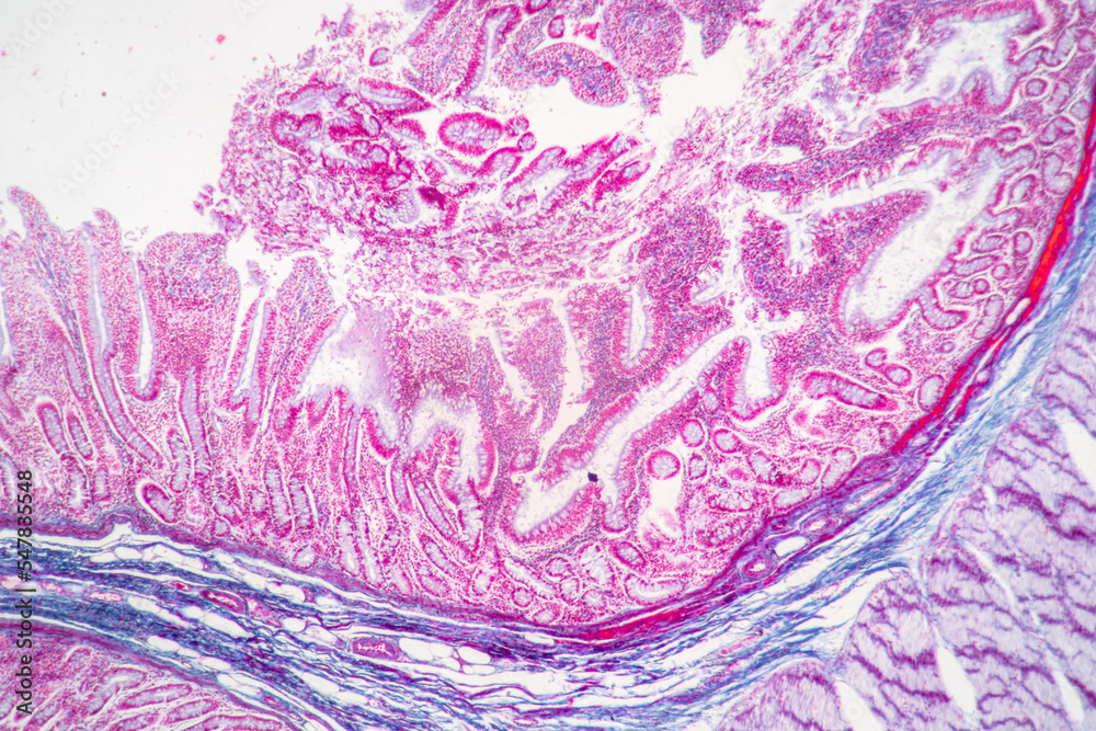 Backgrounds of Characteristics Tissue of Stomach Human, Small intestine ...