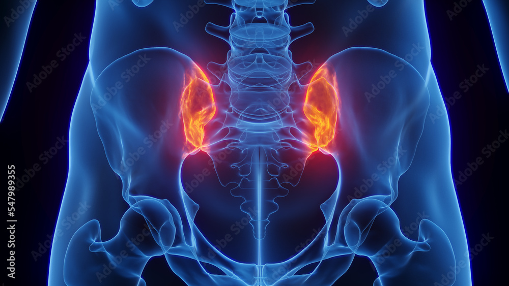 3D rendered Medical Illustration of Male Anatomy - Inflamed Iliosacral ...