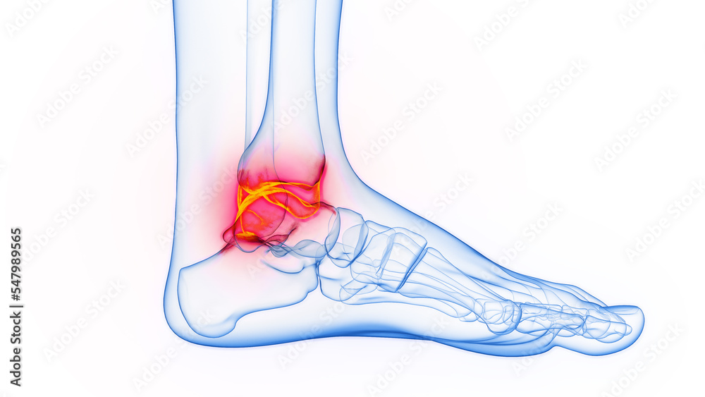 3D rendered Medical Illustration of Male Anatomy - Inflamed Ankle ...
