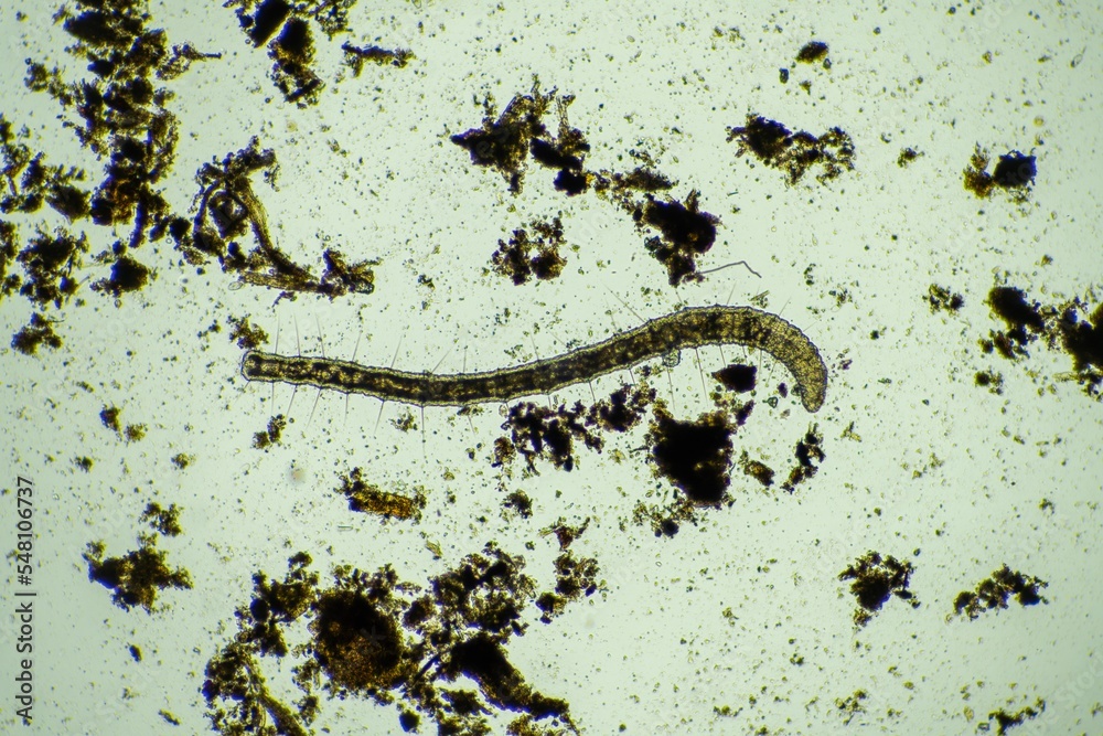 human parasite. gut intestinal infection disease. microorganism ...