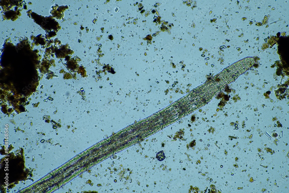 human parasite. gut intestinal infection disease. microorganism ...