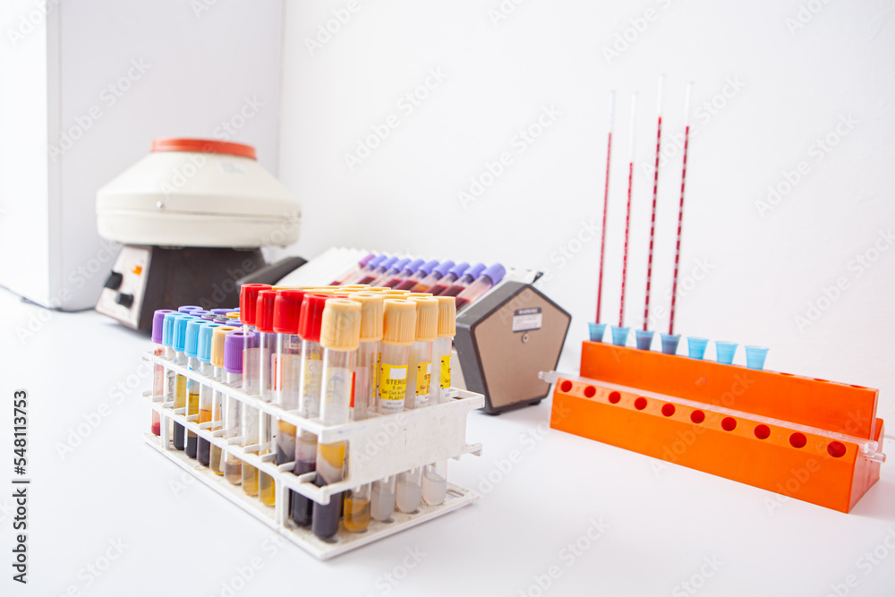 different types of tubes for blood tests Stock Photo | Adobe Stock