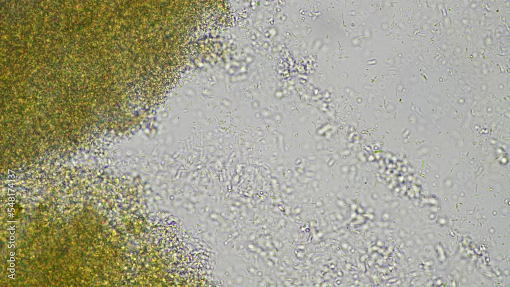 baby feces under the microscope looking at poo with bacteria and bugs ...
