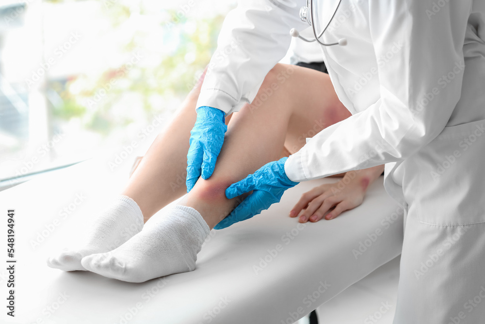 Female doctor examining patient's bruised leg in clinic Stock Photo ...