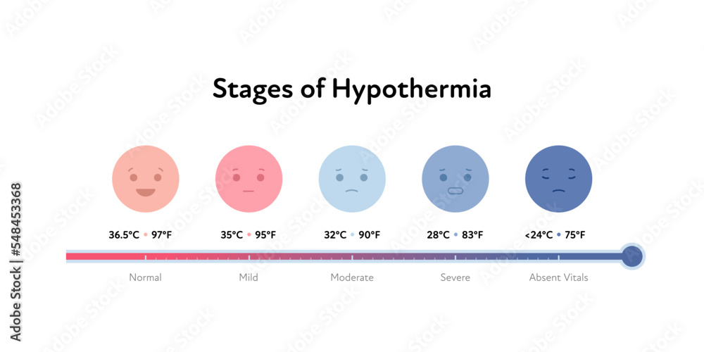 Frostbite and hypothermia health care infographic collection. Vector ...