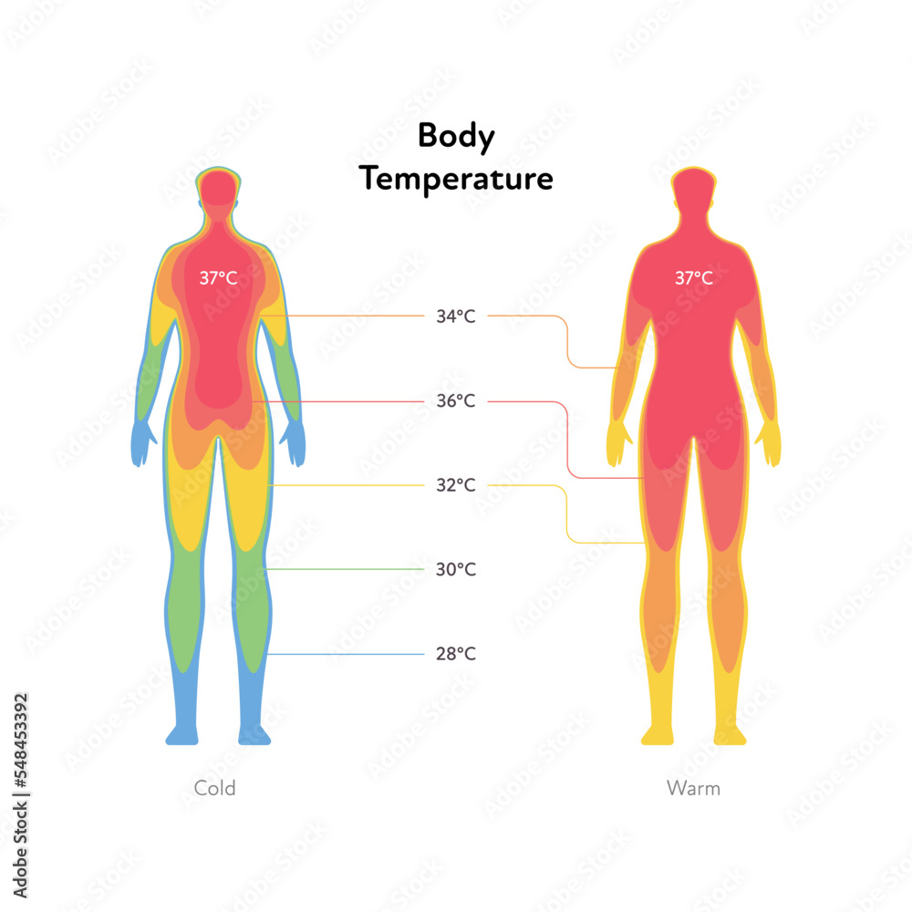 Hyperthermia and hypothermia health care infographic. Vector flat ...