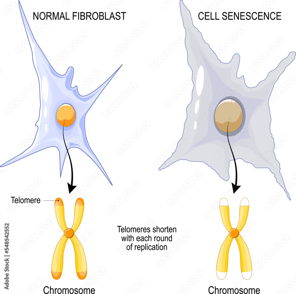 Telomeres of Chromosome in Normal fibroblast and Cell senescence. Stock ...