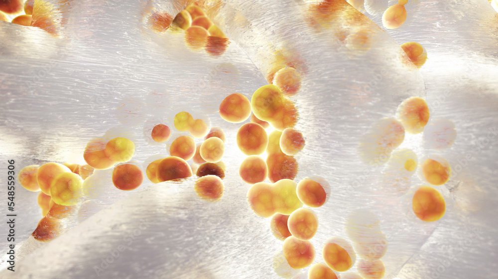 Poster Colony of Staphylococcus aureus bacteria – Wall Art | UkPosters