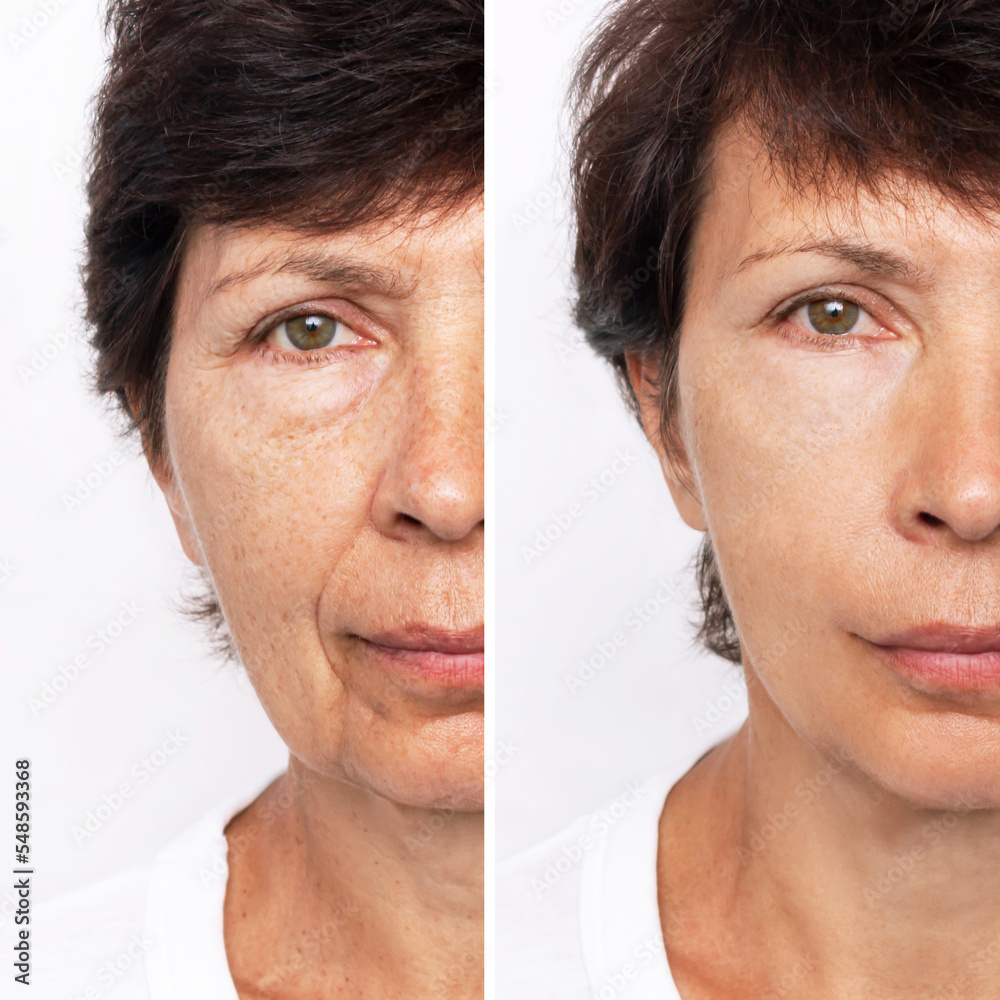 Comparison of aged and young woman's face. Youth, old age. The process ...
