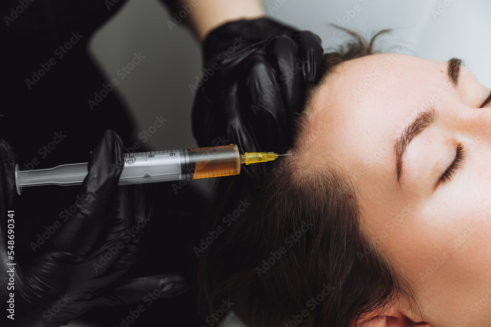 Plasma injection into the hair on a woman 's head .a cosmetologist ...