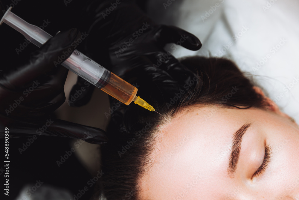 Foto de Plasma injection into the hair on a woman 's head .a ...