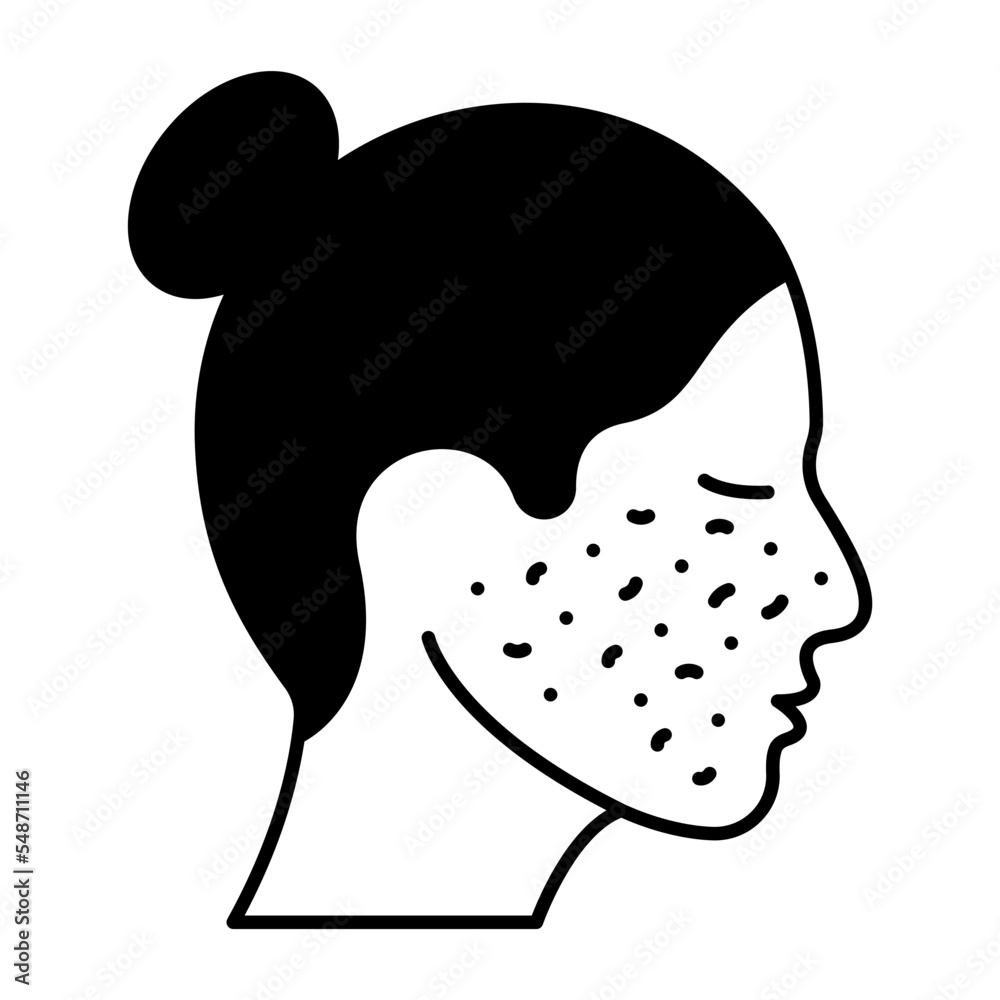 Acne Treatment concept, Skin Resurfacing or Microdermabrasion vector ...