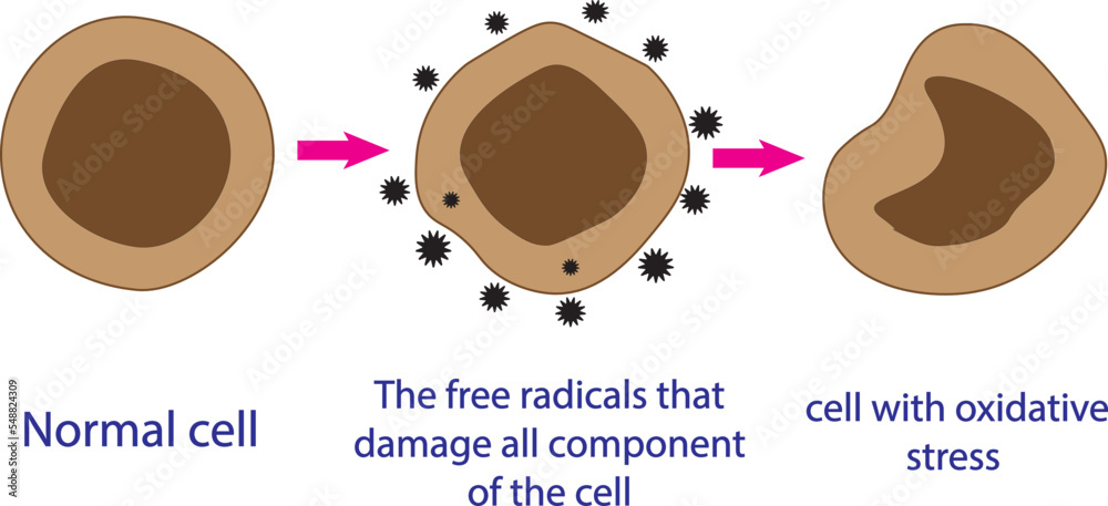 Oxidative stress. From normal cells, to oxidative stress and aggressive ...