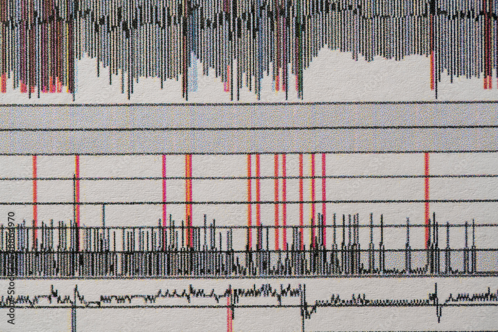 Images charts scientific cardiograms of cardiorespiratory sleep ...