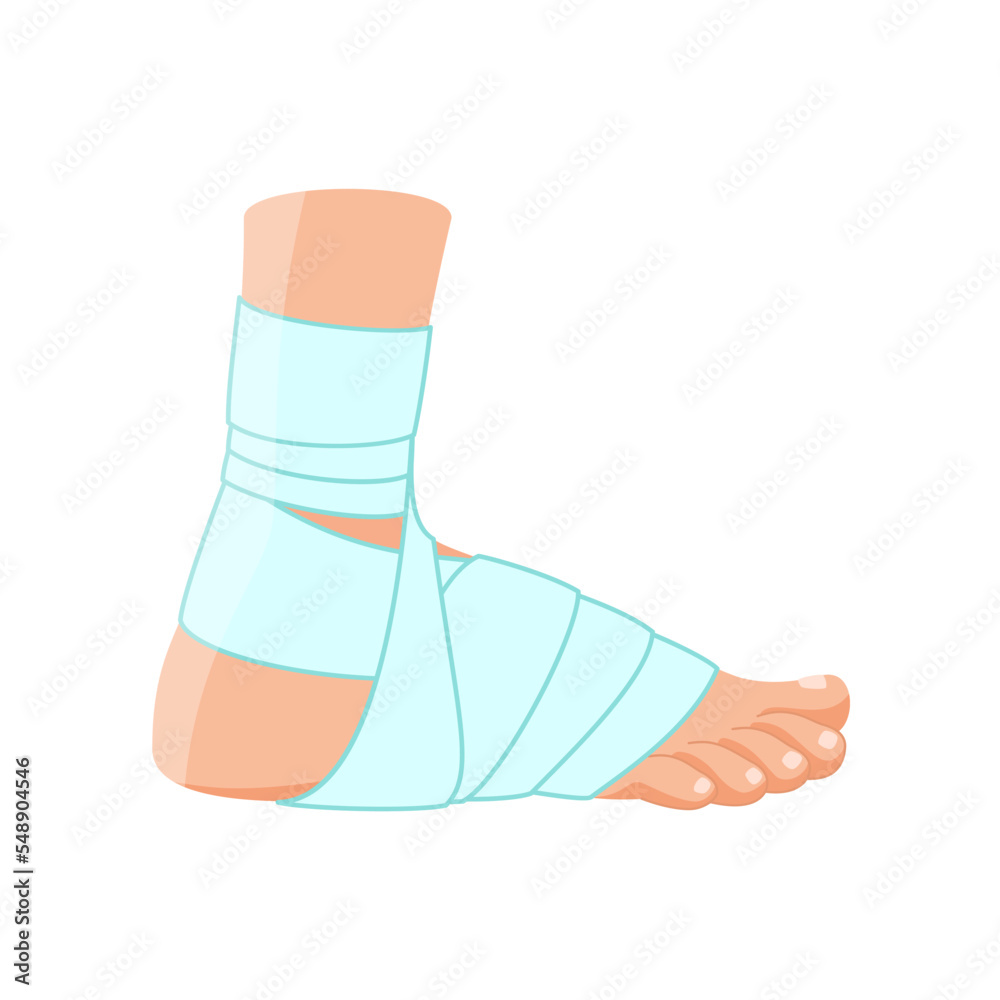 Man with bandaged ankle and foot cartoon illustration. Fracture ...