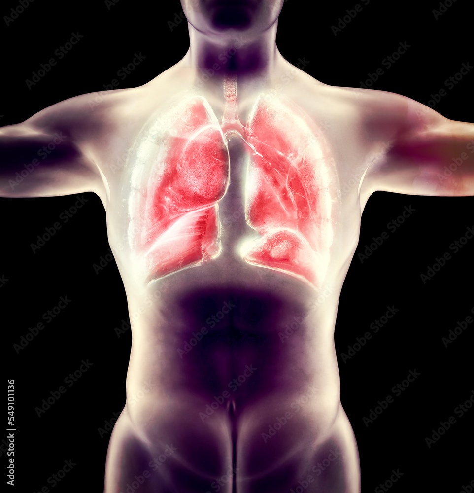 Human anatomy, problems with the respiratory system, severely damaged ...