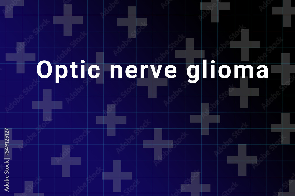 Optic nerve glioma disease Illustration. Optic nerve glioma title on ...