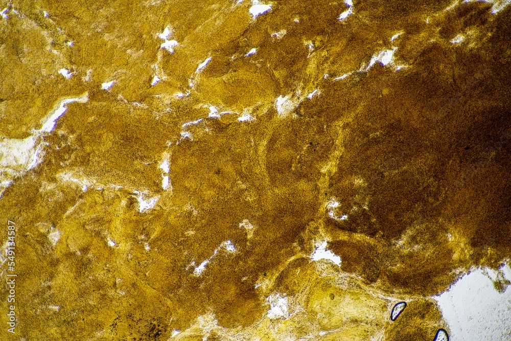 baby faeces under the microscope looking at poo with bacteria and bugs ...