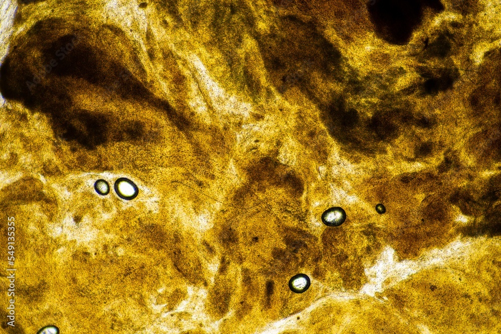 baby faeces under the microscope looking at poo with bacteria and bugs ...