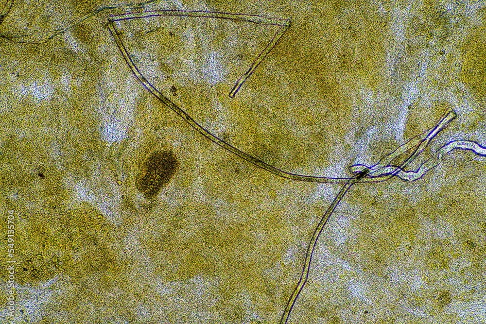 baby faeces under the microscope looking at poo with bacteria and bugs ...
