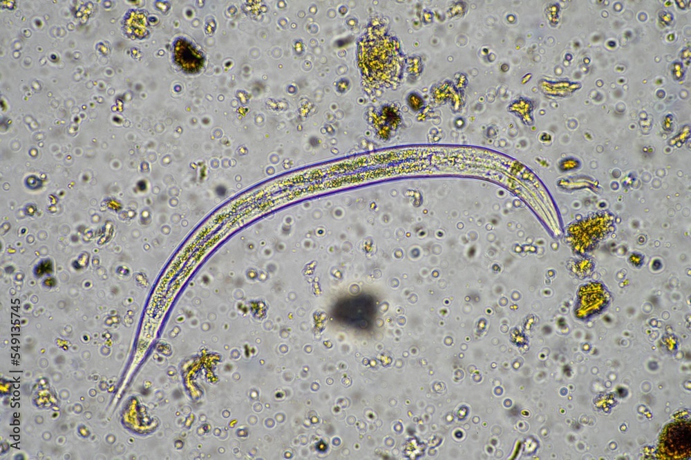 microorganisms and soil biology, with nematodes and fungi under the microscope. in a soil and ...