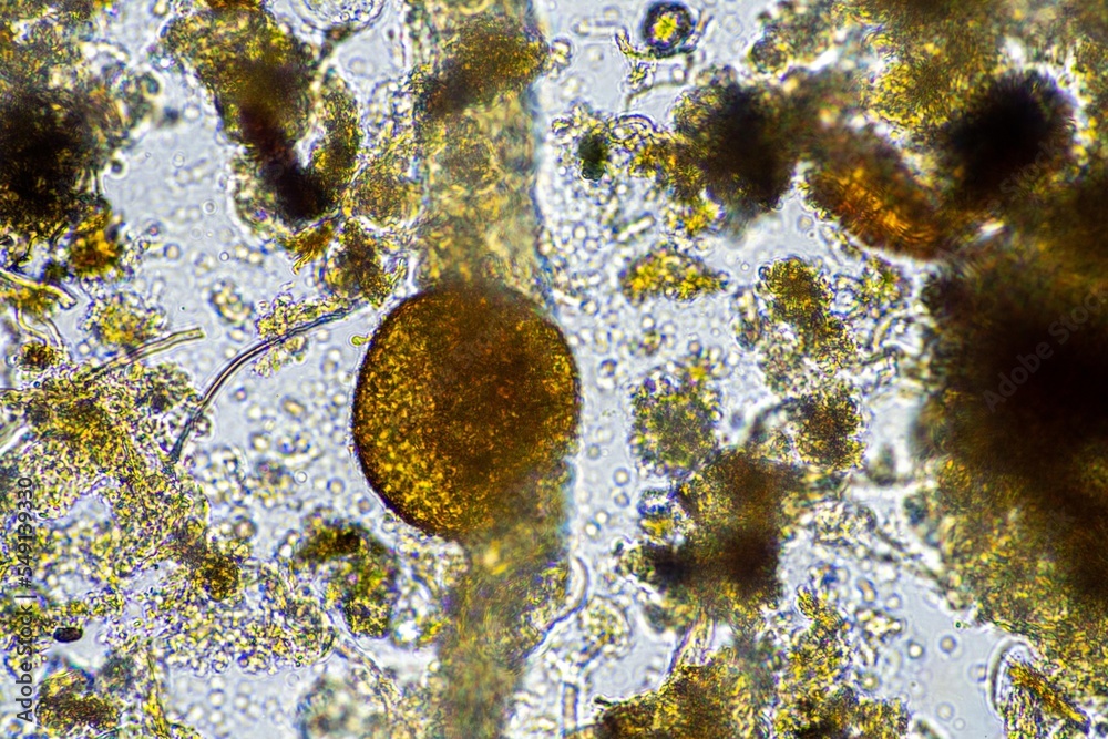 soil fungi and microorganisms in a soil and compost sample Stock Photo ...