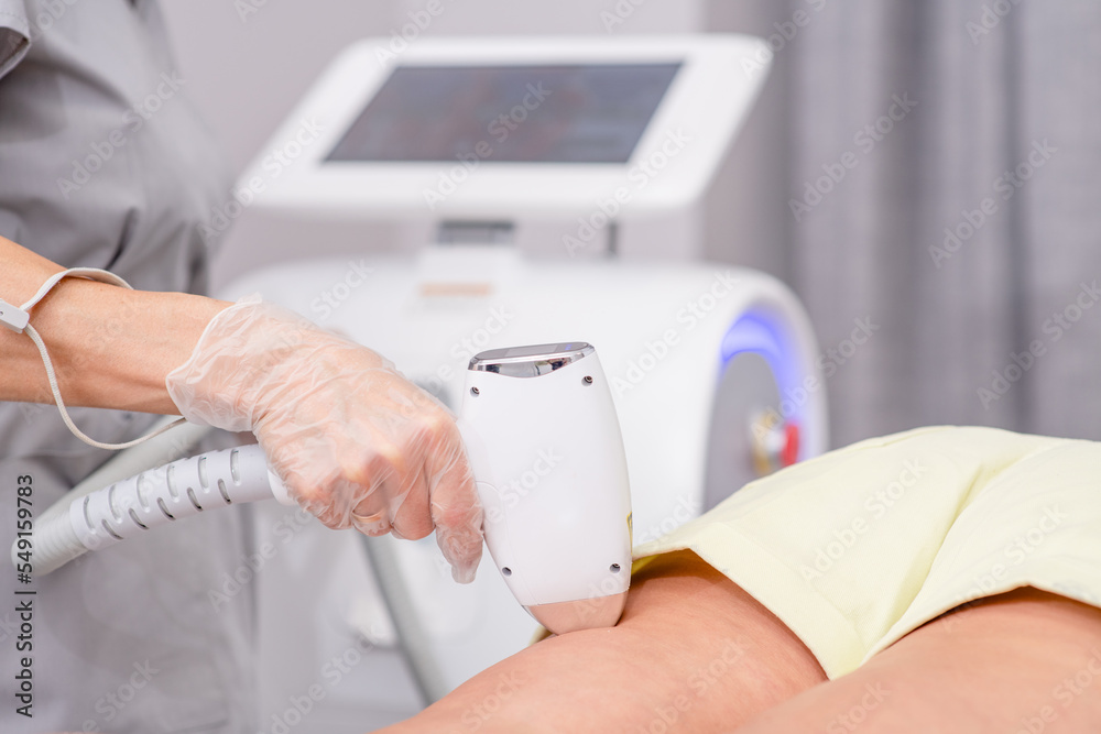 Professional beautician removes hair on female buttocks of senior woman using a laser. hair ...
