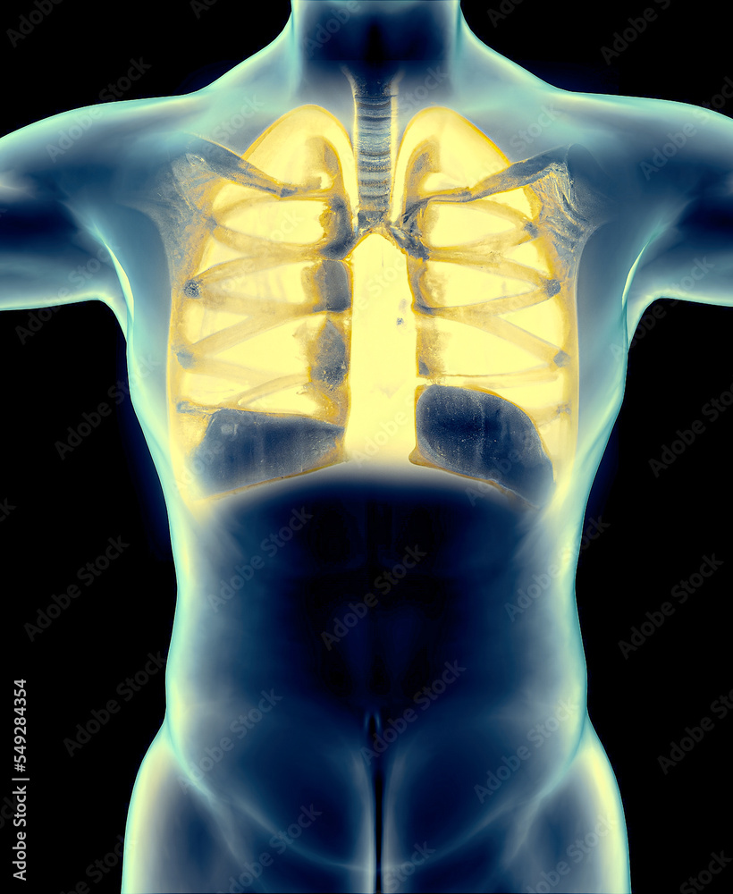 Human anatomy, problems with the respiratory system, severely damaged ...