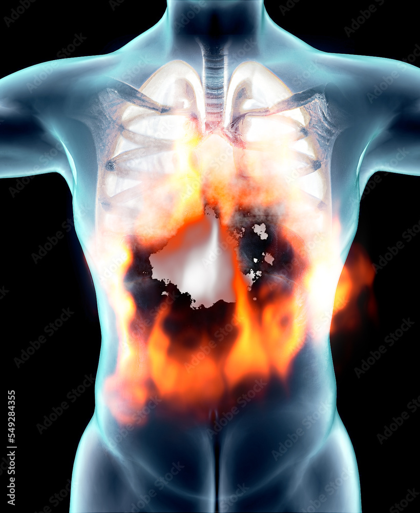 Human anatomy, problems with the respiratory system, severely damaged ...