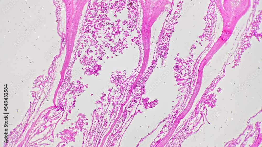 Longitudinal section of human lung filmed under microscope 200x against ...