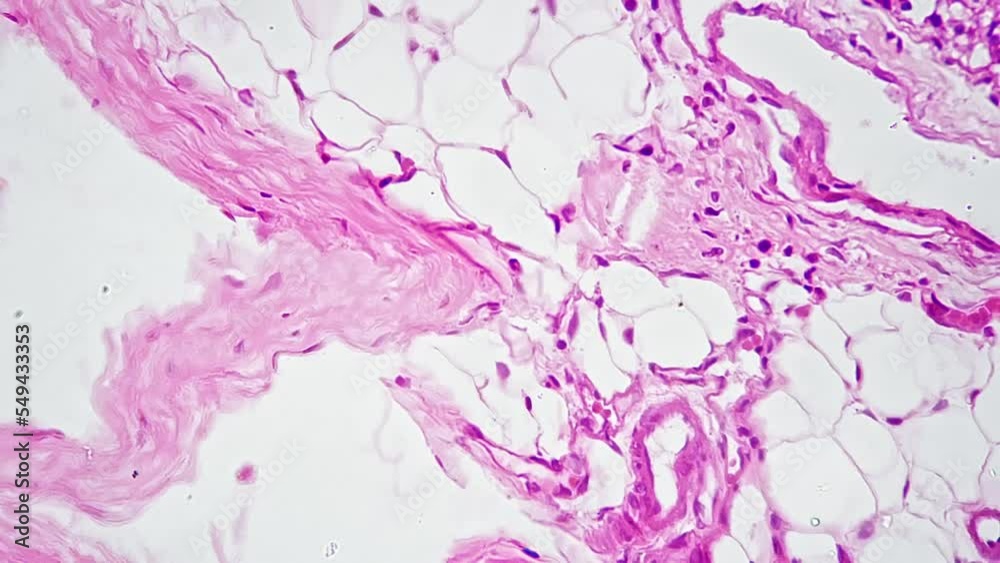 Lymph node in section magnified under microscope in 400x times on ...