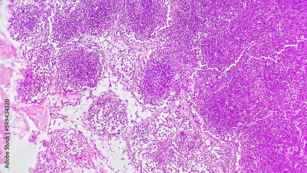 Lymph node in section filmed under microscope 100x on bright field ...