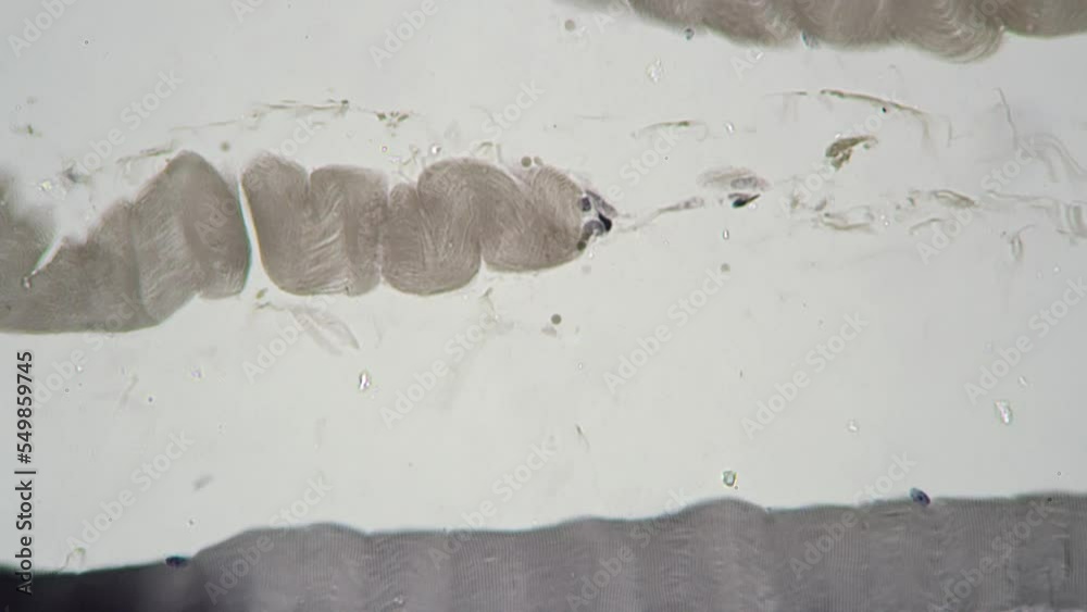 Skeletal muscle L.S. under microscope filmed with 400 times ...