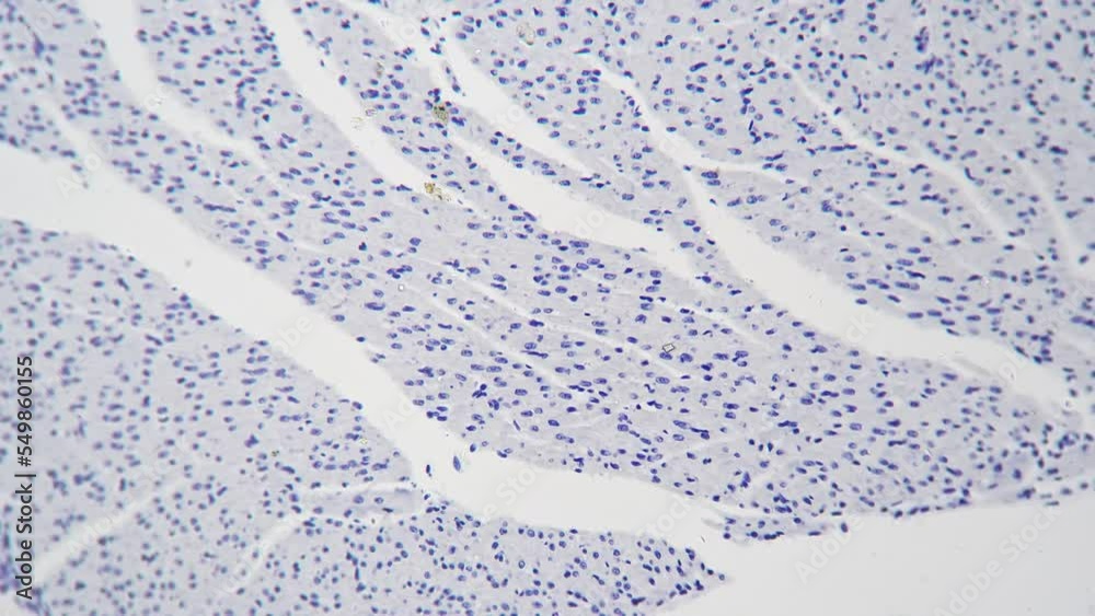 Cardiac muscle in section filmed on bright field background under ...